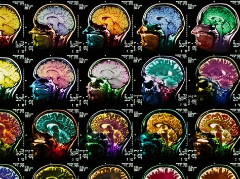 Brain Structures Rem Sleep