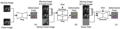 論文レビュー Diffusereg Denoising Diffusion Model For Obtaining Deformation Fields In Unsupervised