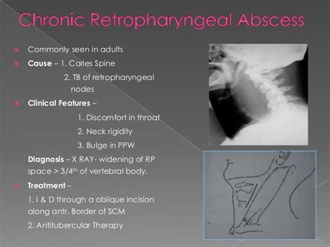 Anatomy Of Neck Spaces And Infections