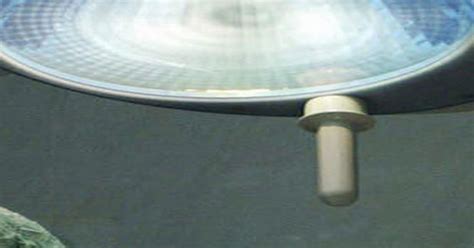 Sex Swap Ops Treble In Years Daily Star