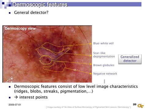 PPT Dermoscopic Interest Point Detector And Descriptor PowerPoint