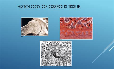 Practical 1 Histology Of Osseous Tissue Diagram Quizlet