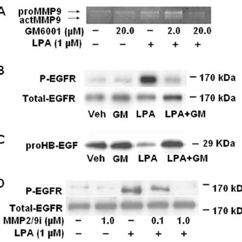 Lpa Induces Tyrosine Phosphorylation Of Egfr In Hbepcs Download