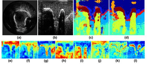 Example Of Ivus Image Classification By M 2 Ssl First Row Ivus Image