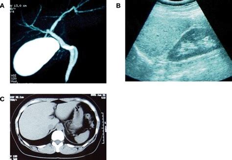 Preoperative Diagnostic Imaging A DIC CT Revealed No Abnormalities Download Scientific