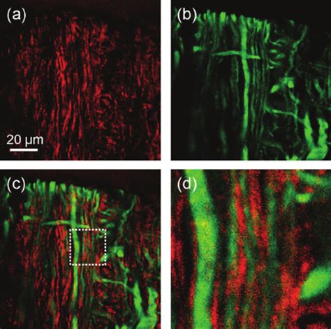 ͑ color ͒ multimodal cars tpef imaging of rat spinal cord ͑ a ͒