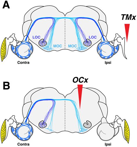 Schematics Of The Auditory Periphery Including The Tm The Cochlea And Download Scientific