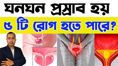 বারবার প্রস্রাব হচ্ছে বড় কোন রোগের লক্ষণ নয় তো ইউরিন বেশি হলেই