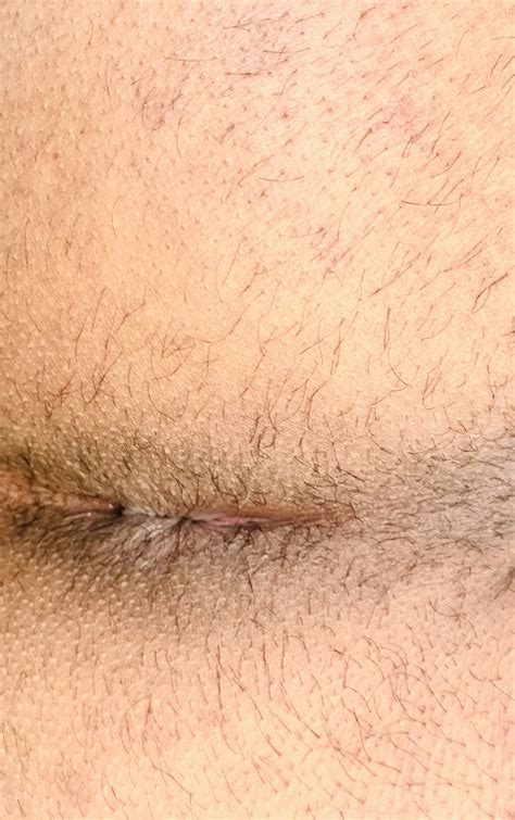 Close Up Asshole Pics Xhamster