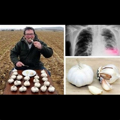 Започнах да ям по скилидка чесън всеки ден ето какво се случи с тялото ми след една година