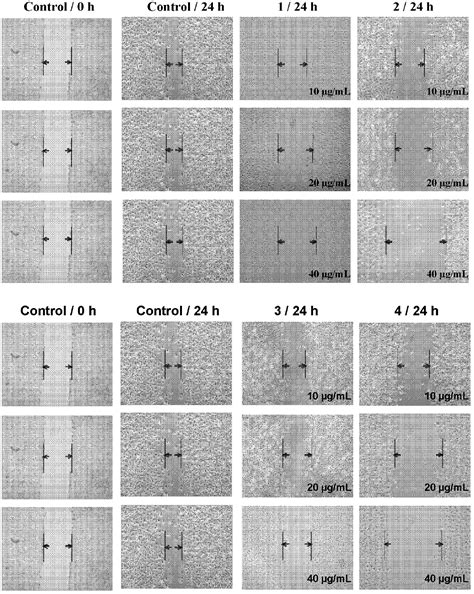 Ruthenium Complex Capable Of Inhibiting Tumor Angiogenesis And
