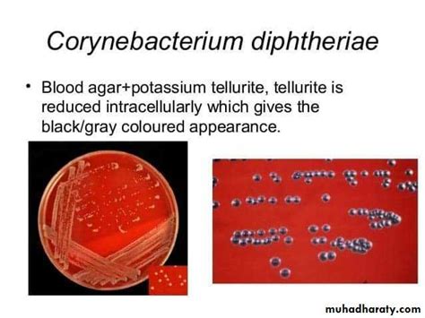 Biotypes Of Corynebacterium Diphtheriae 55 Off