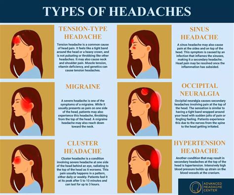 Common Types Of Headaches To Worry About Advanced Headache Center In 2025 Headache Types