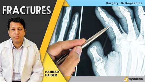 Fractures Introduction