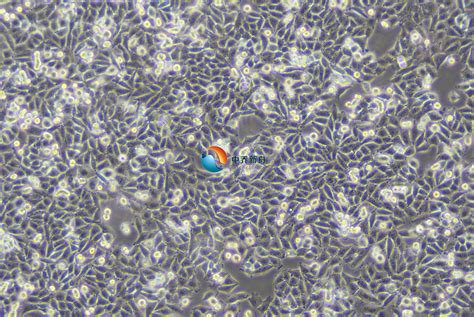 A375细胞 细胞株 人恶性黑色素瘤细胞 中乔新舟生物科技有限公司