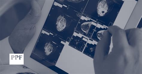 Ppf Group Padcev Plus Keytruda Under Fda Priority Review For Urothelial Cancer