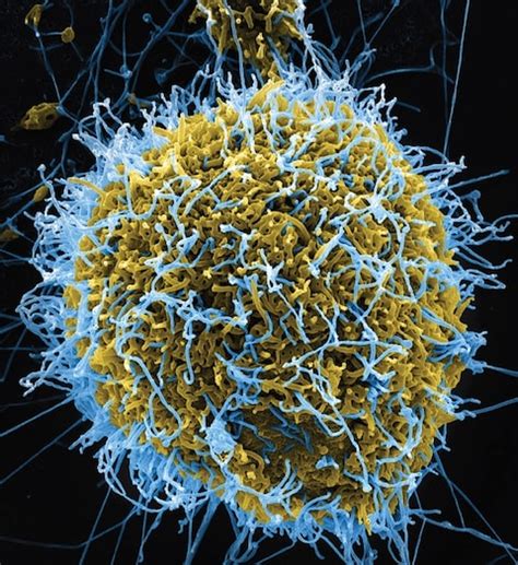 Can You Catch Ebola From An Infected Blanket The Washington Post