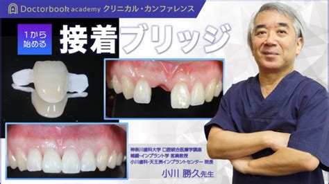 1から始める接着ブリッジ Doctorbook Academy ドクターブックアカデミー