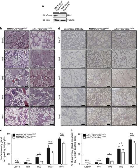 Impaired Cell Death And Mammary Gland Involution In The Absence Of