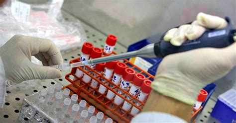 Cancro osseo primario così il medico che perse un amico ha sviluppato