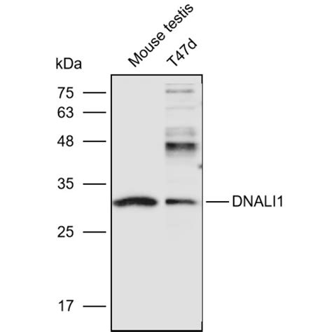 Solarbio K110966p Anti Dnali1 Polyclonal Antibody 试剂仪器耗材