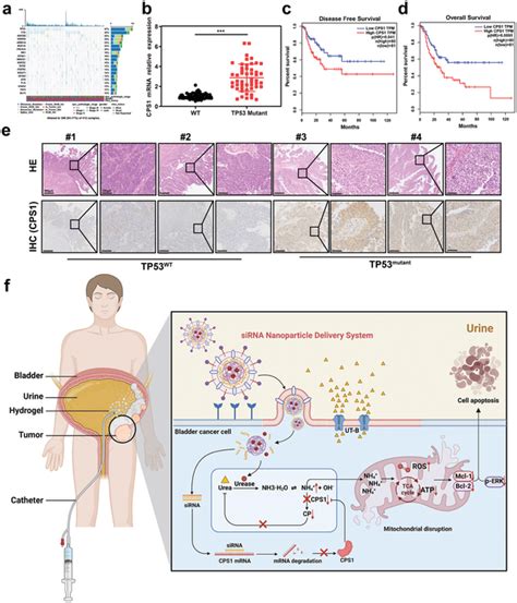 CPS1 Expression Is Almost Always Increased Together With TP53 Mutation