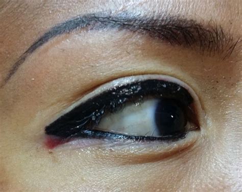 Permanent Cosmetics Eyeliner Before And After Photos