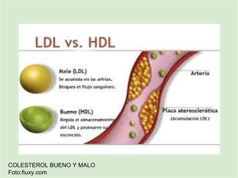 Lugar Salud Un Lugar En El Que Todo Es Salud La Hipercolesterolemia