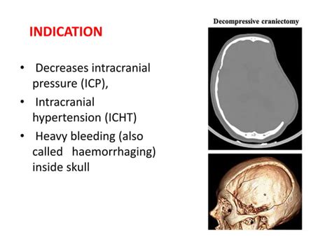 Craniotomypptx Death Injury Or Military Conflict Sensitive Topics