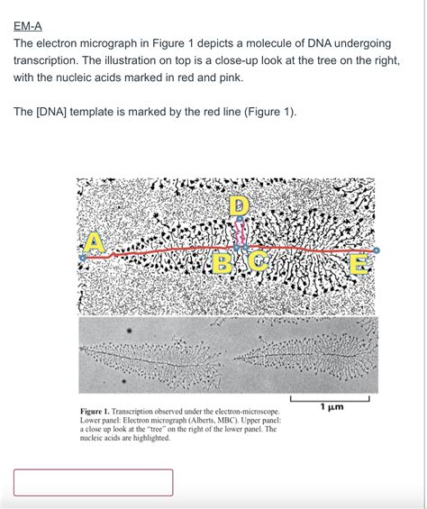 Solved Em A The Electron Micrograph In Figure 1 Depicts A