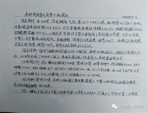 卢老师看心电图 急性前间壁及前壁心肌梗死 2019 6 10 搜狐大视野 搜狐新闻