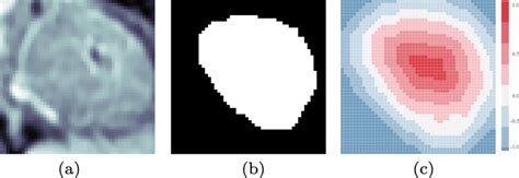 A A Patch Containing The Tumor B The Corresponding Tumor Annotated By