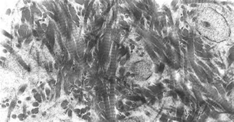 Bone Matrix What It Is Components And Characteristics Psychology 2023