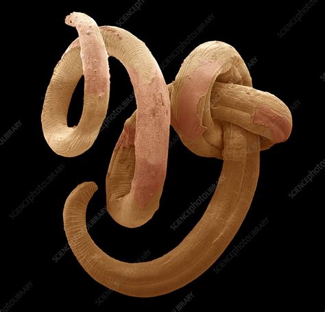 Threadworm Sem Stock Image Z1800231 Science Photo Library