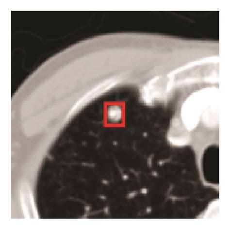 The Examples Of Annotated Cisls In Liss Database A Ggo B Download Scientific Diagram