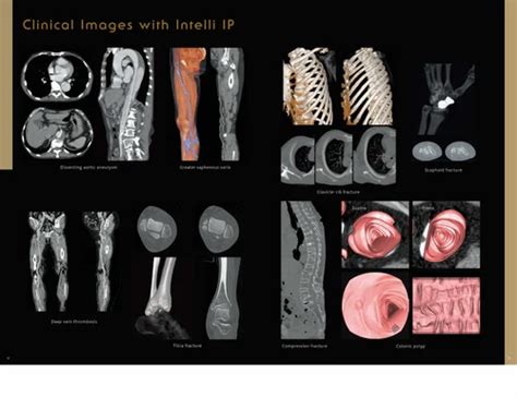Fujifilm 32 Slice New Ct Scan Machine Supria For Hospital At Best
