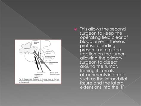 Infratemporal Fossa Approaches