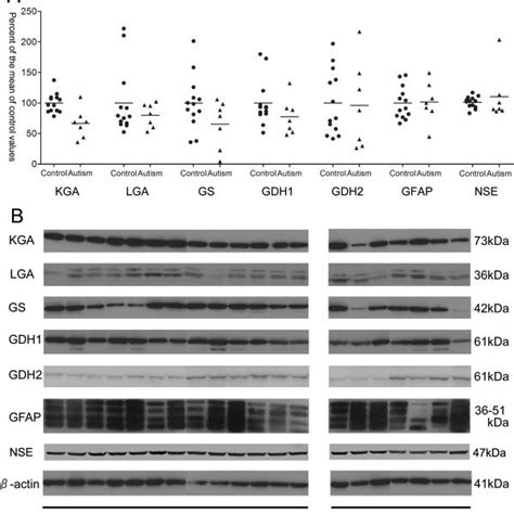 Expression Levels Of Enzymes Associated With The Glutamate Glutamine