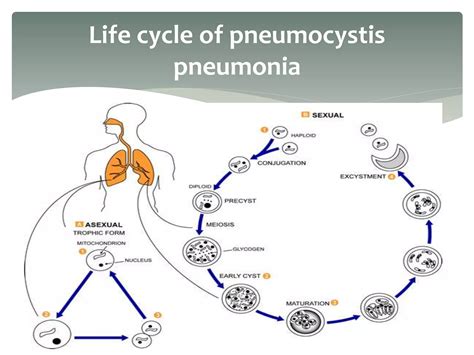 Pneumocytis Pneumoniapptx 4pptx