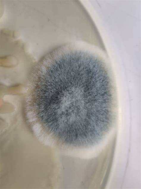 Aspergillus Fumigatus Colonies On Saboraud Dextrose Agar Medium Stock