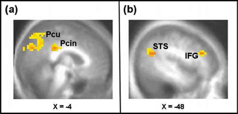 Functional Connectivity Of Auditory Cortex In Older Adults During