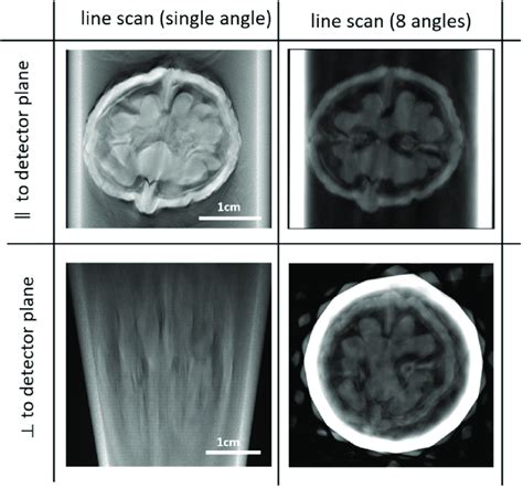 Ct Reconstruction Of A Single Walnut From A Single Conveyor Belt Line Download Scientific
