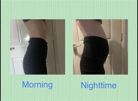 Ablation Vs Excision Graphic Not Sure If This Has Been Shared Here But Its A Helpful Graphic