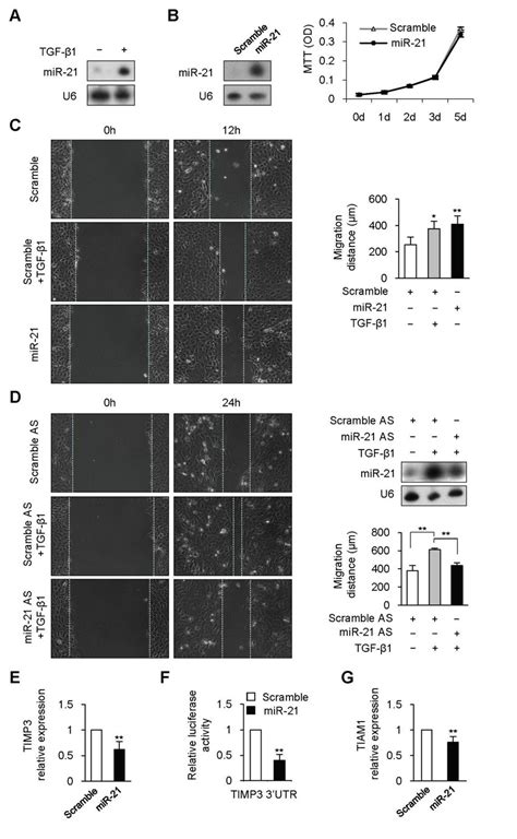 Tgf β1 Upregulated Mir 21 Expression To Promote Keratinocyte Migration