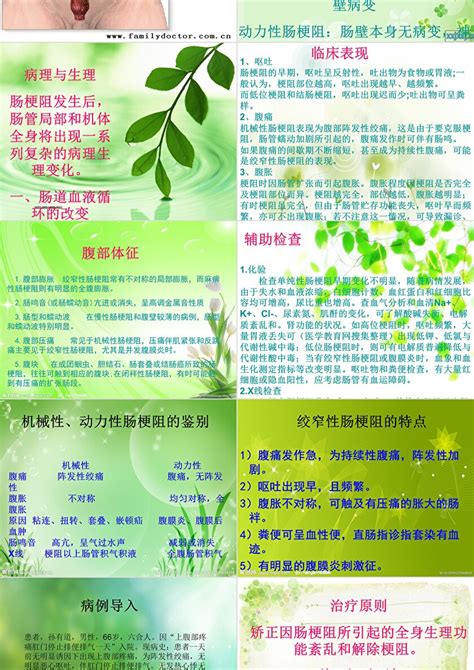 肠梗阻护理查房ppt卡卡办公