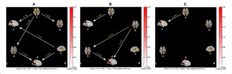 The Resting State Effective Connectivity Comparison Between Cfs Download Scientific Diagram