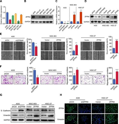 Zfp64 Promotes Gc Cell Migration And Invasion In Vitro A B The Zfp64