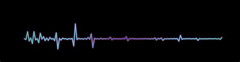 Synth Waves Collection Opensea