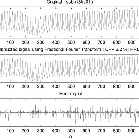 Compression Waveform Of Record Sshs01m Using Fractional Fourier