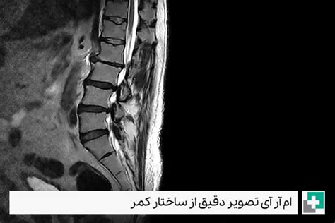 هر آنچه باید در مورد ام آر آی کمر بدانید؟ از قبل تابعد انجام